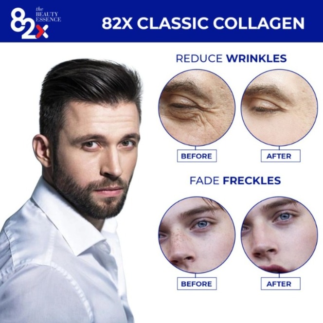 82X Classic Collagen 120,000mg Marine Collagen Peptides Supplement from ...