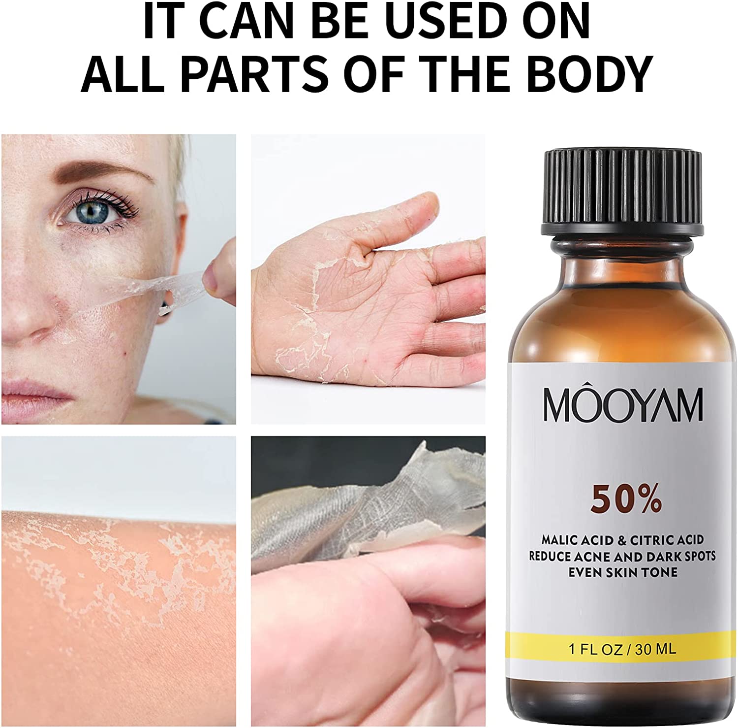 Effectively Inhibit Oil Secretion, Improve Acne and Prevent ...