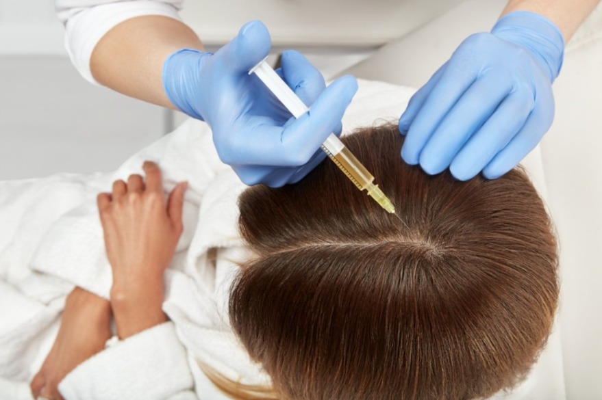 Does Platelet Rich Plasma Therapy Trigger Hair Growth? | Vipon